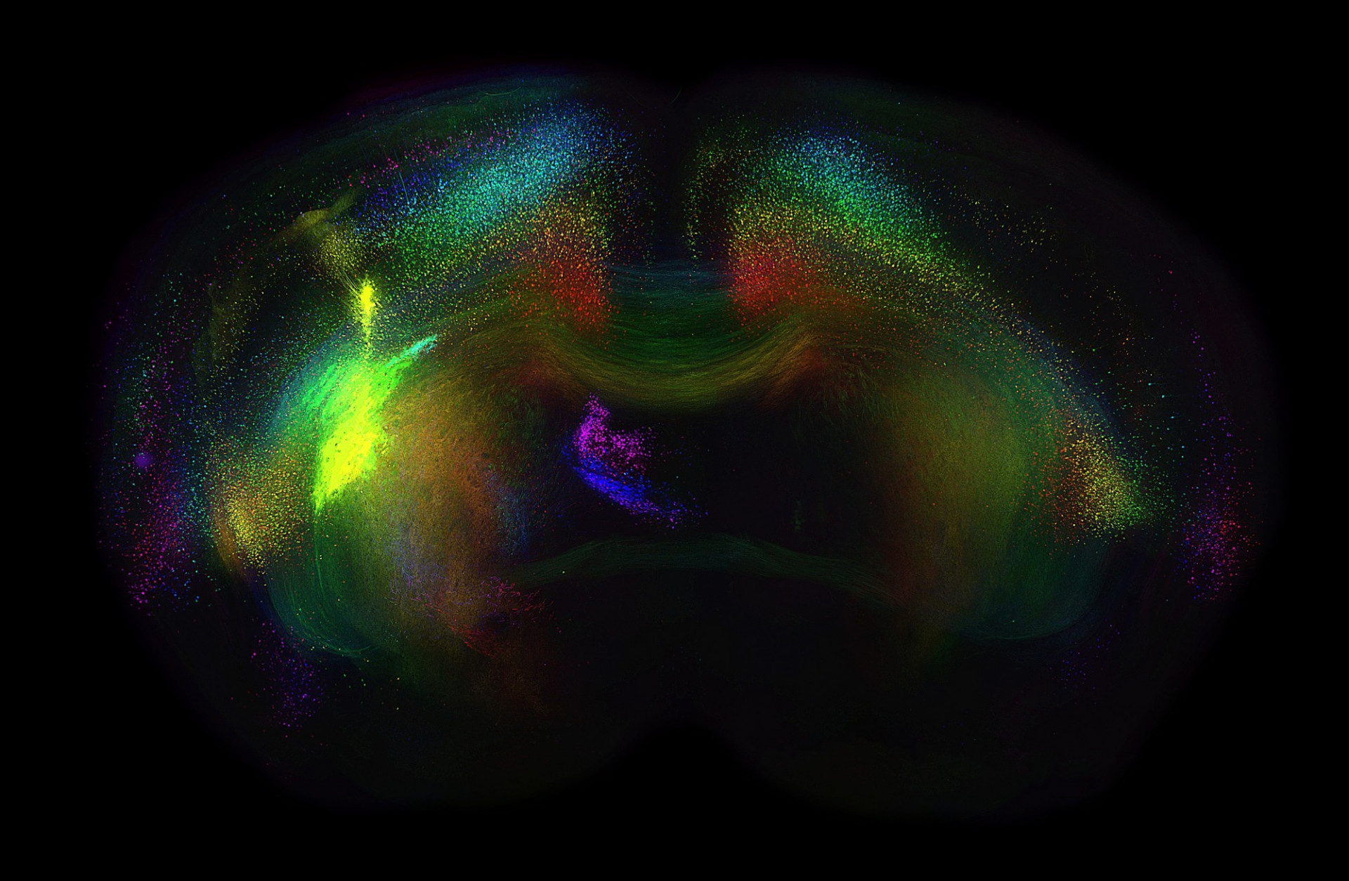 Project 5 Closed Loop Manipulations Motor Control Brain U19